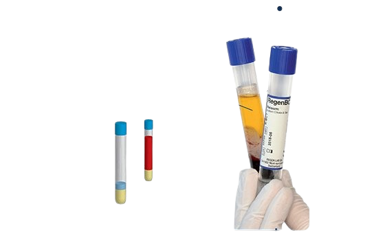 Regenkit A-PRP – Angelmed Asia