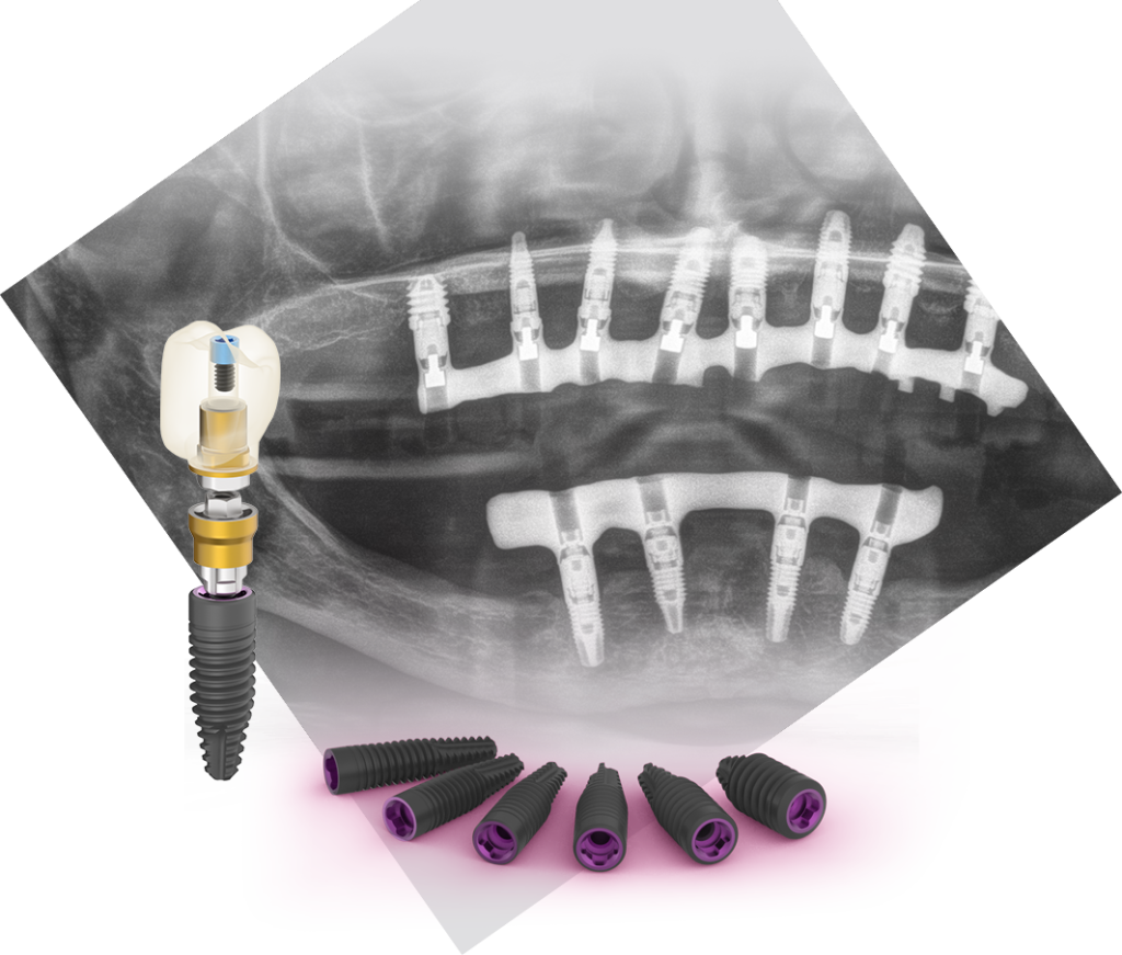BTI CORE implant system: Evolution and simplicity – Angelmed Asia